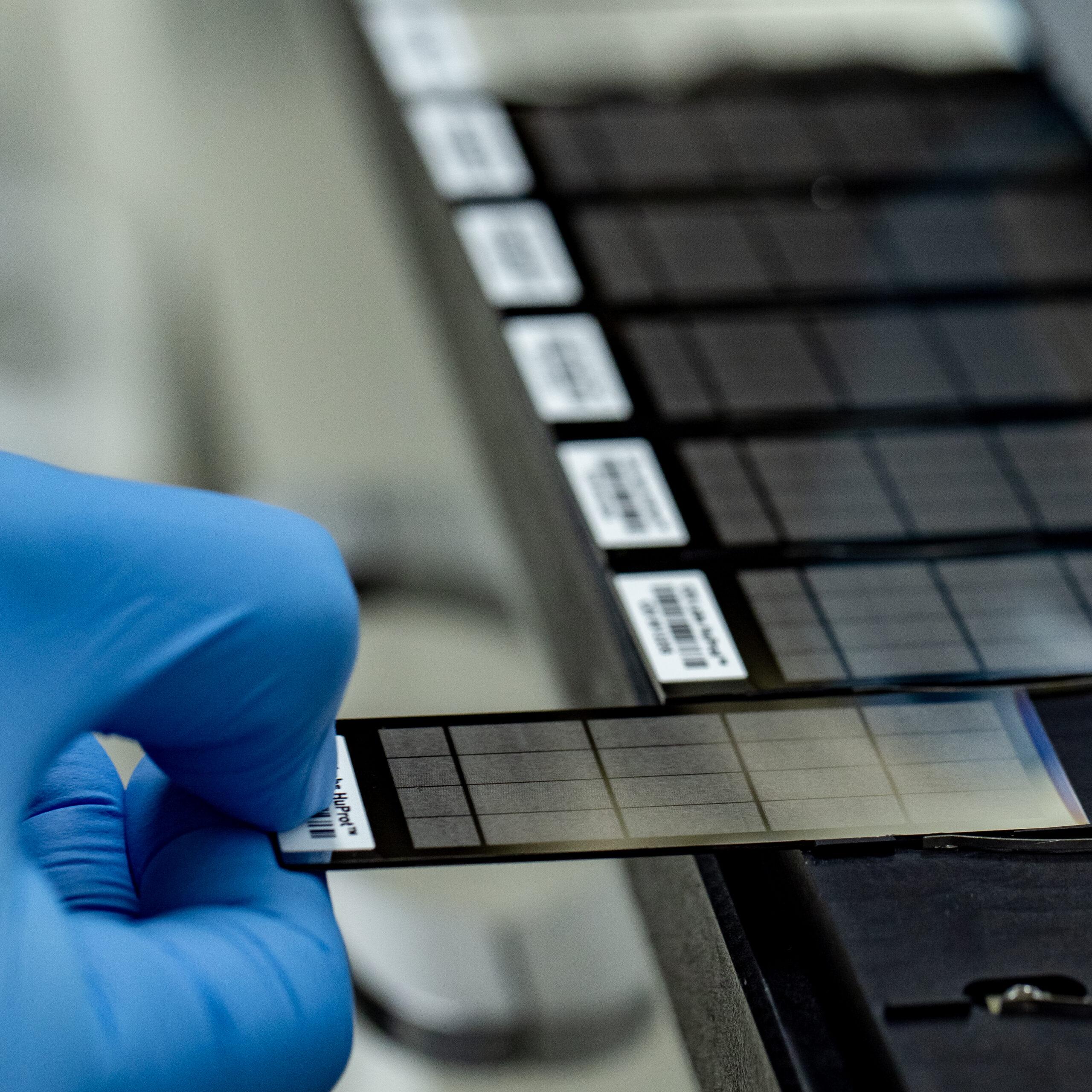 CDI Laboratories: the largest Human Proteome Array (HuProt™)